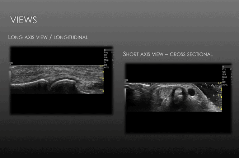 Start your MSK ultrasound training