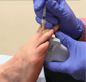 More information here