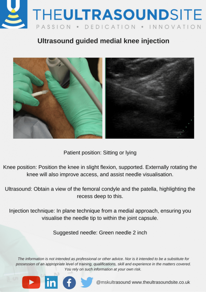 Medial approach USGI knee injection