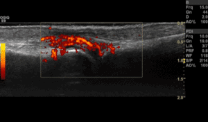 Wakefield et al. Musculo-skeletal ultrasound including definitions for ...